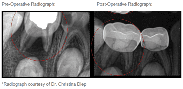 Hearn-Lesion Sterilization and Tissue Repair – CSPD